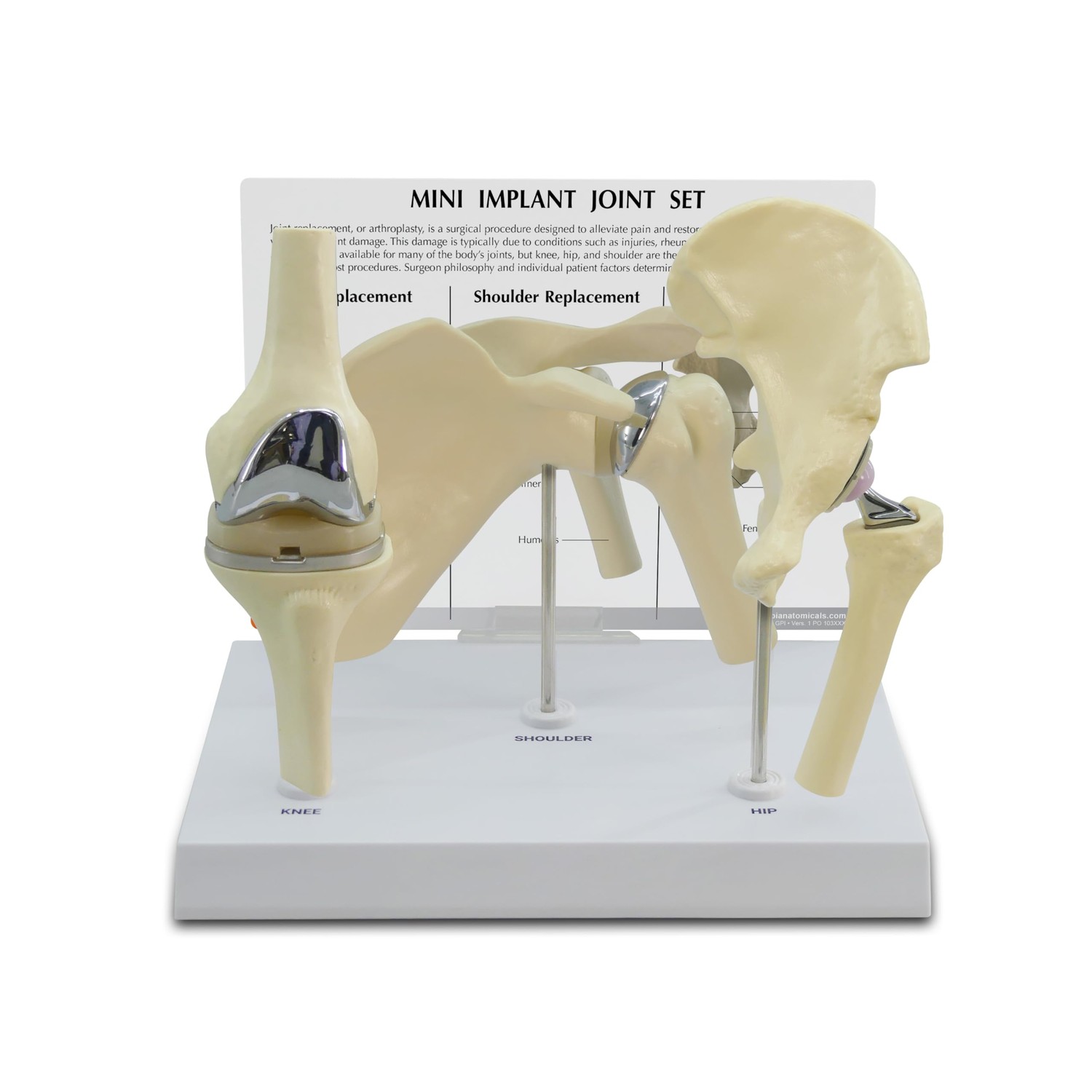 GPI Anatomicals 3-Piece Mini Implant Joint Set for Anatomy, Physiology ...