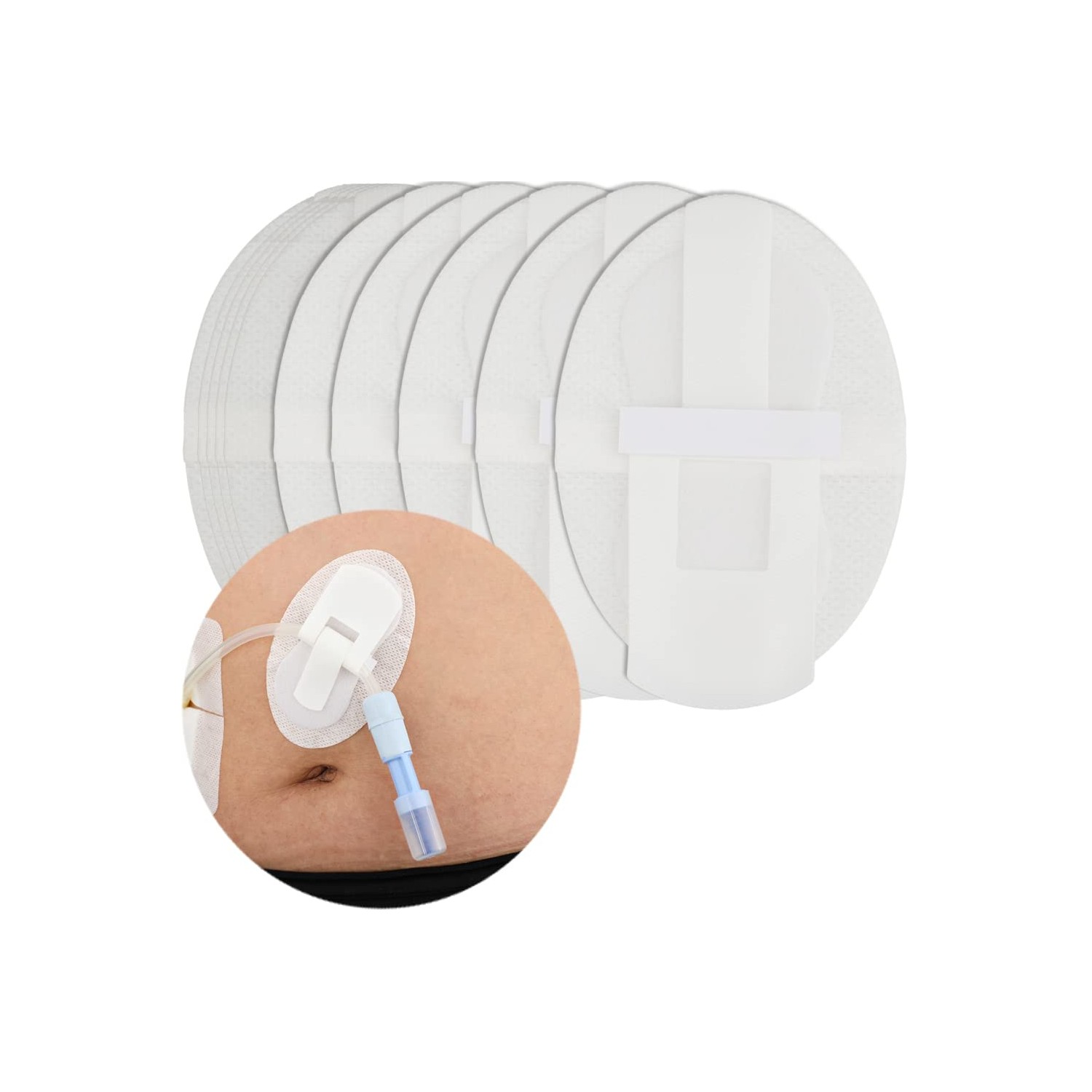 Peritoneal Dialysis PD Catheter Holder Adhesive Patch Stabilization ...