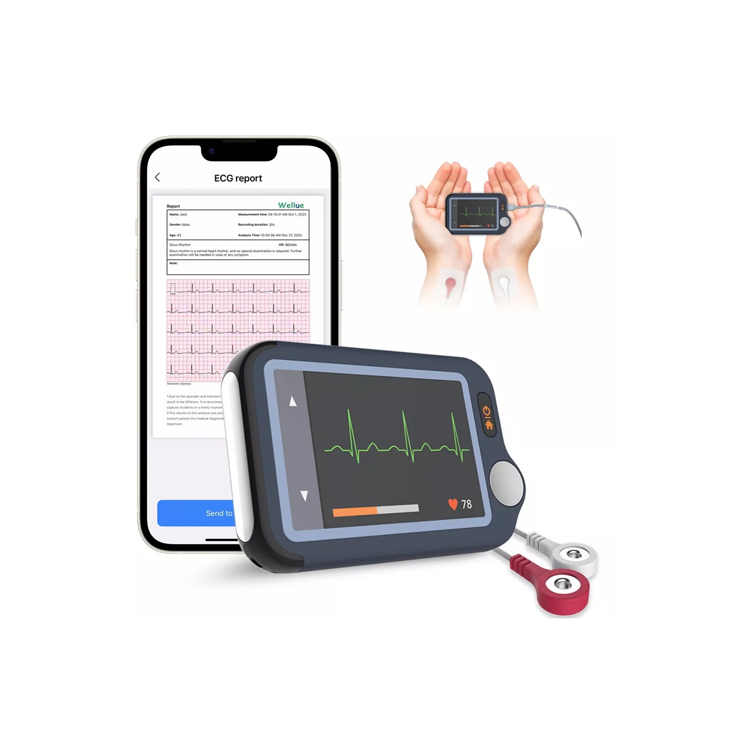 YZ ECG EKG Monitor Heart Monitor with free AI ECG Analysis 30s/60s/5min ...