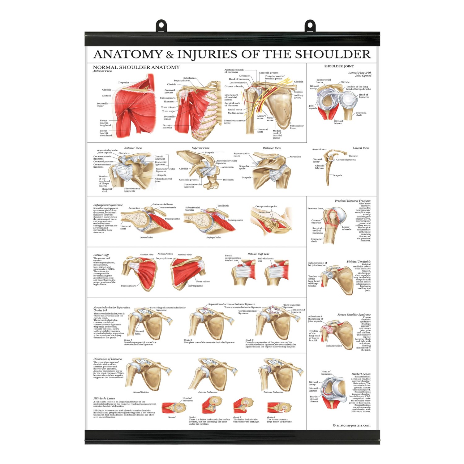 Palace Learning LAMINATED Anatomy and Injuries of the Shoulder Poster ...