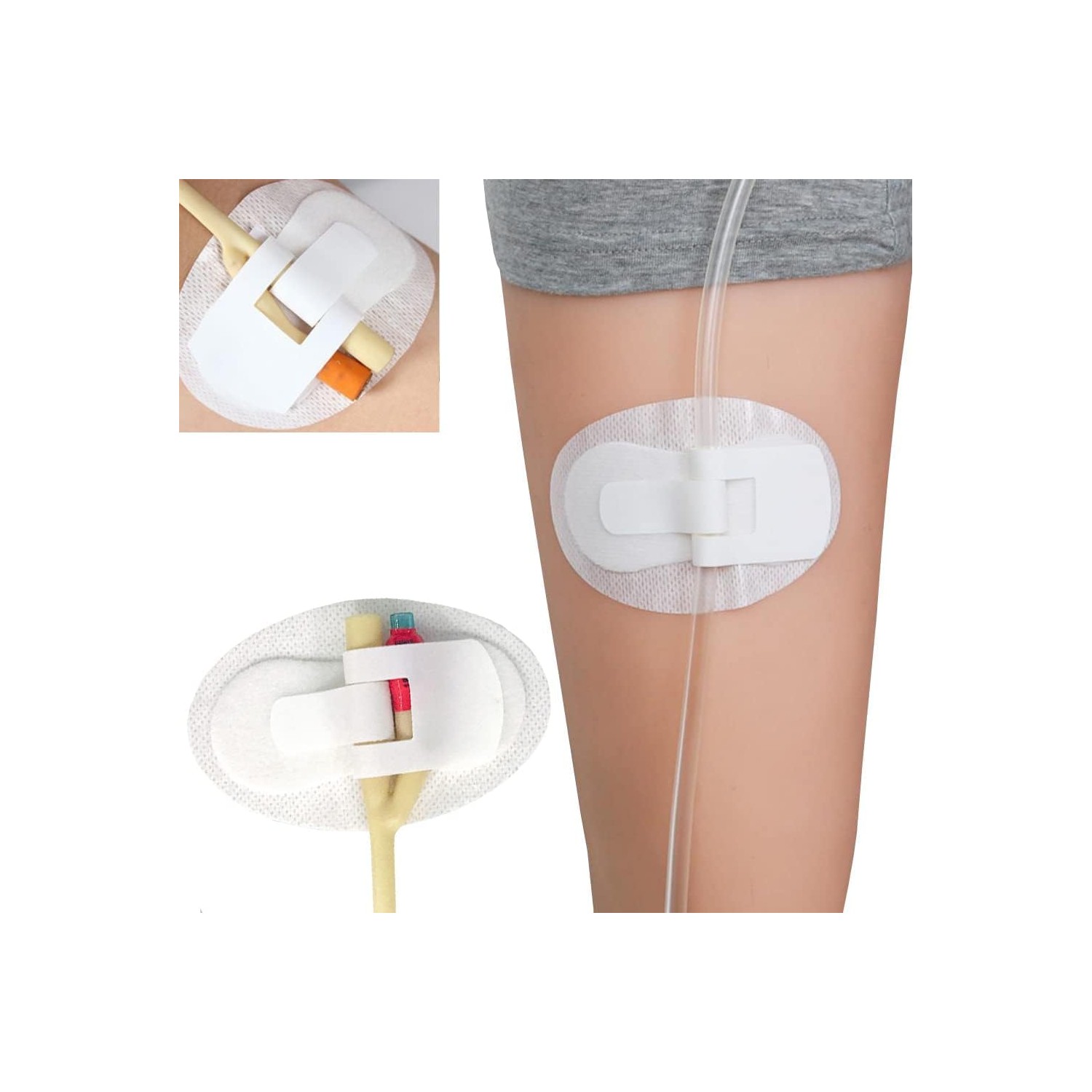 Catheter Stabilization Device Catheter Bag Holder Catheter Legband ...