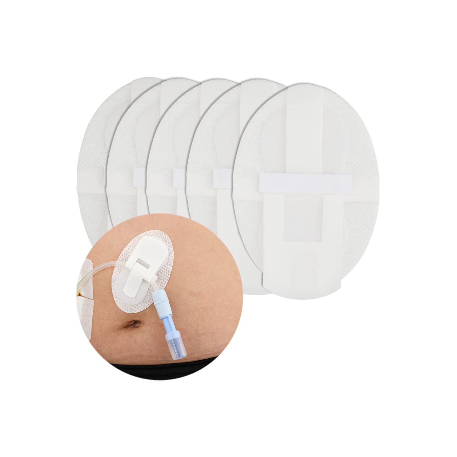 Peritoneal Dialysis PD Catheter Holder Adhesive Patch Stabilization ...