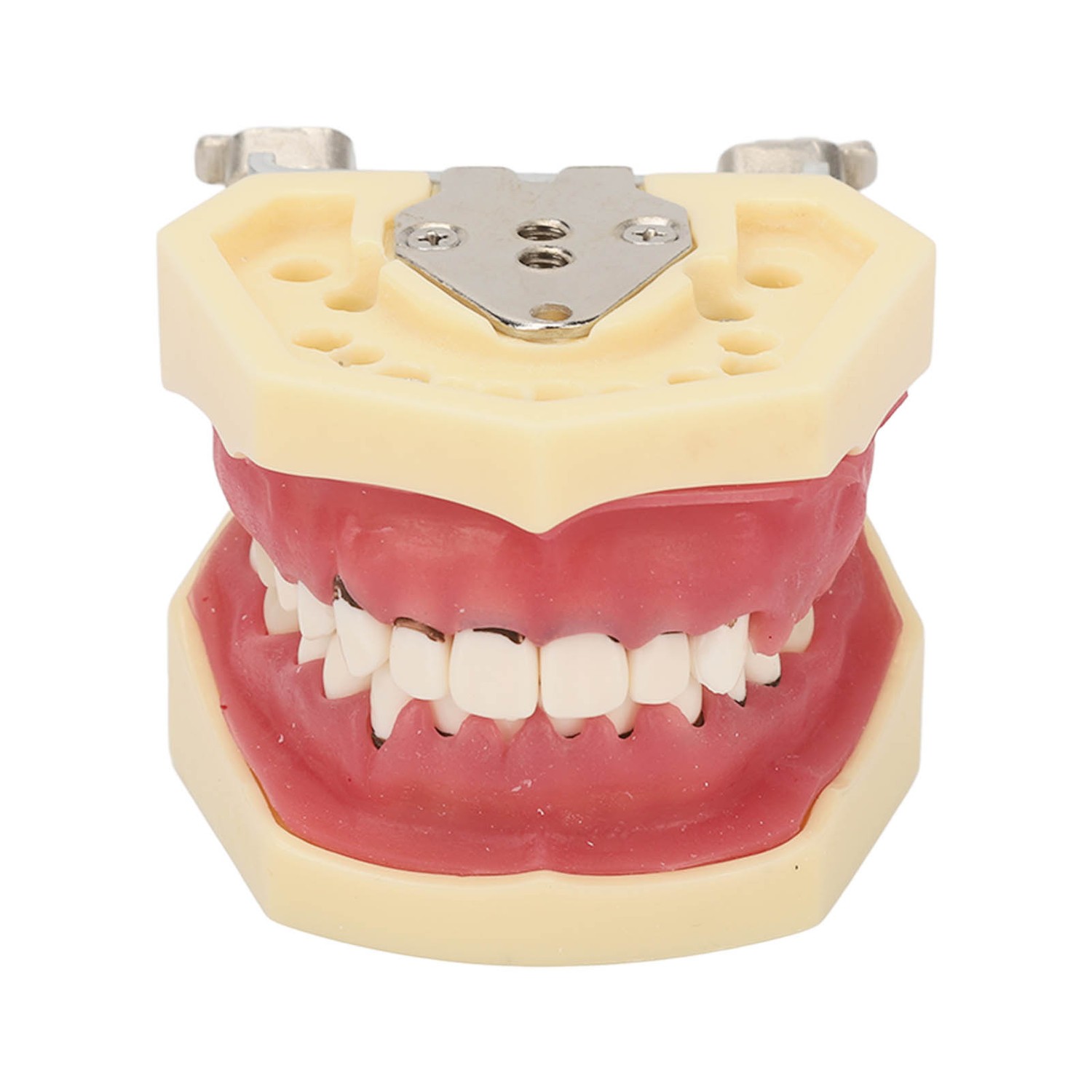 Periodontal Disease Teeth Resin Model Dental Demonstration Teeth Model ...