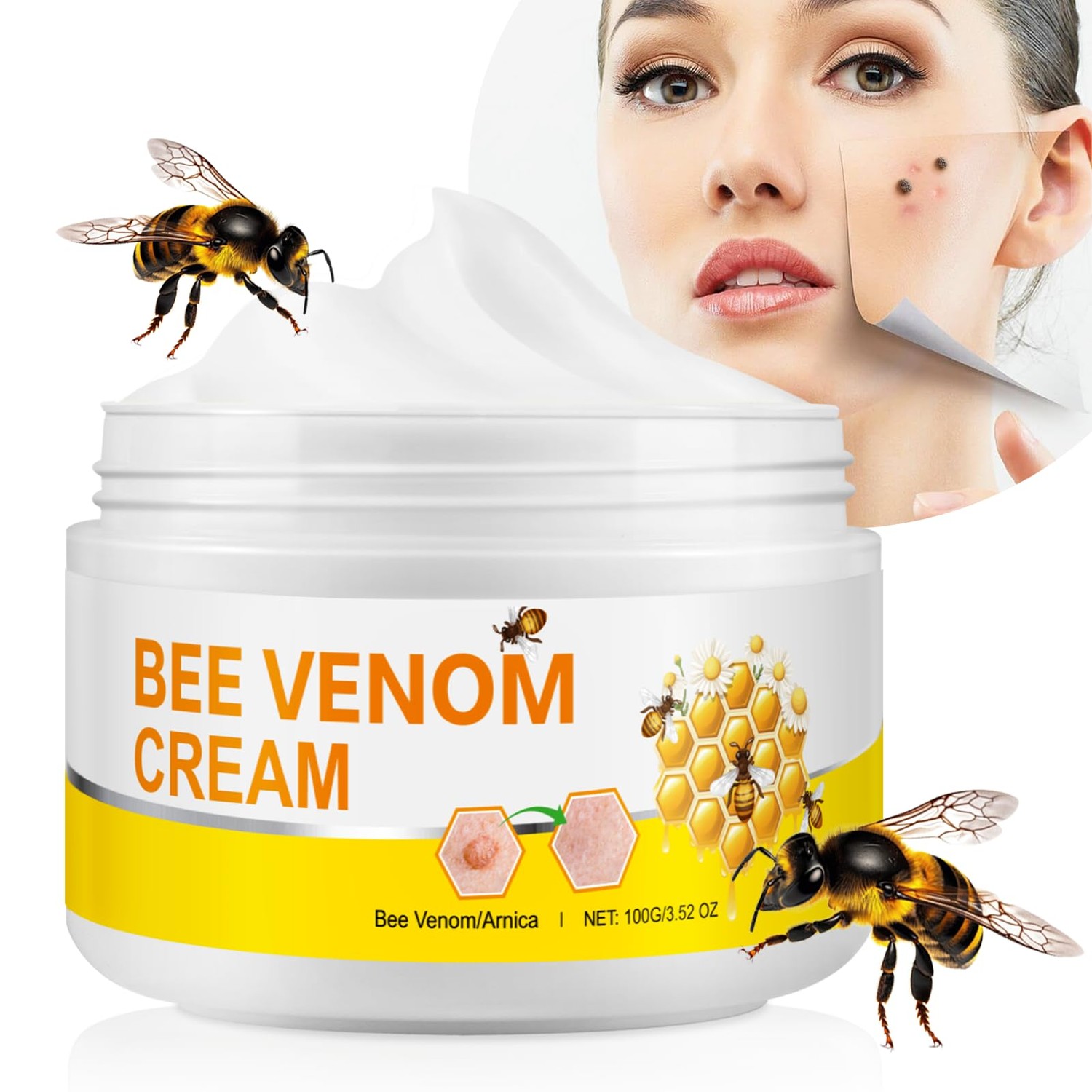 Bee Venom Cream, Bee Venom Mole and Wart Cream, Bee Venom Wart and Tag ...